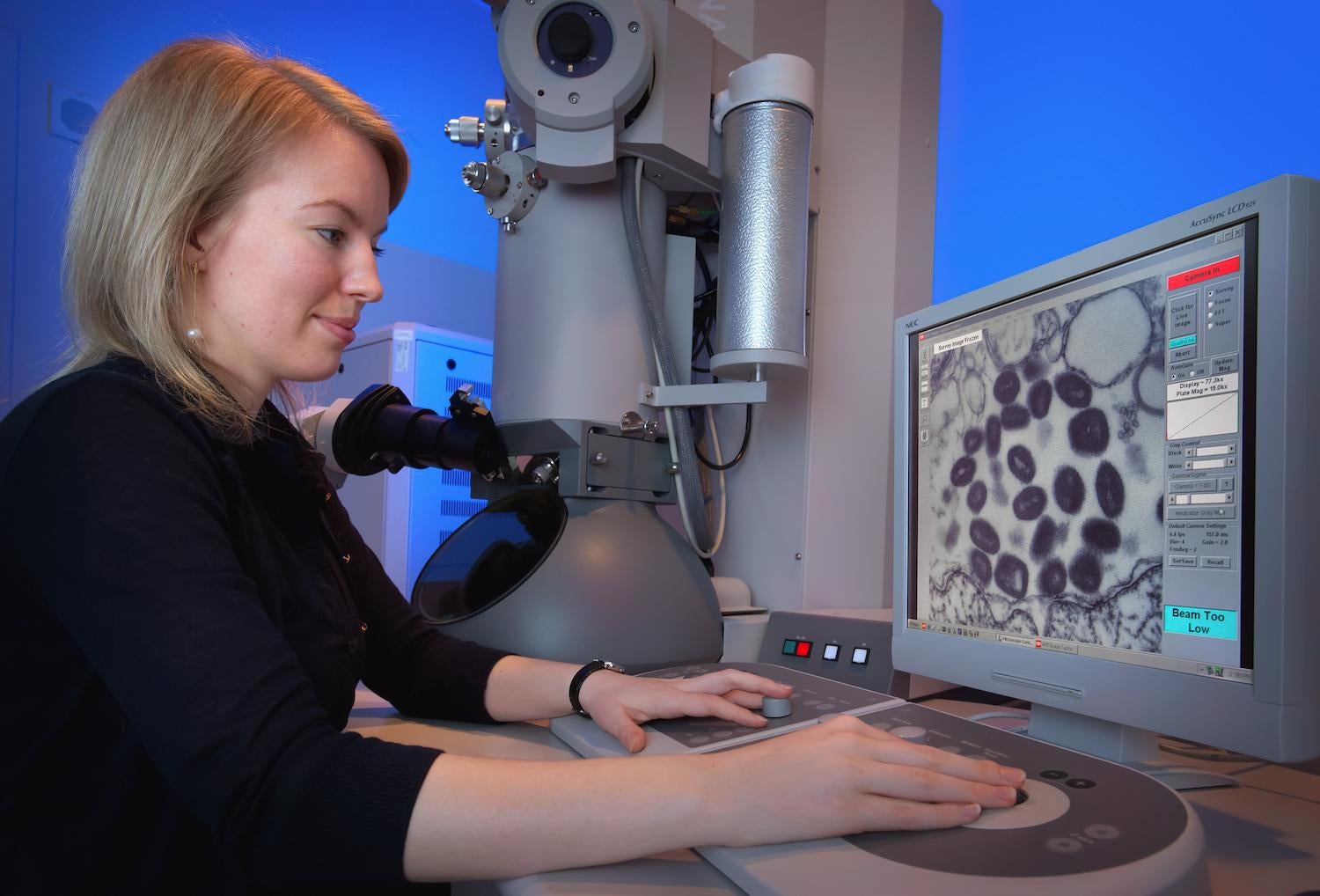 Electron Microscope Images